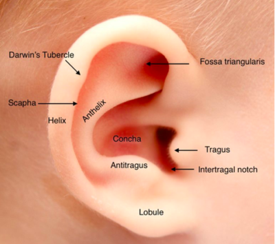 Helix deformities - EarWell.eu