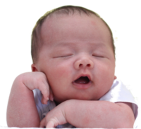 Ear deformities in babies - EarWell.eu