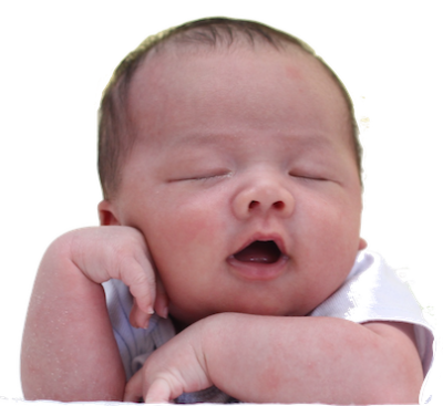 Ear deformities in babies - EarWell.eu